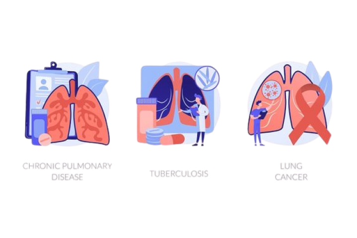 Lung Cancer Detection